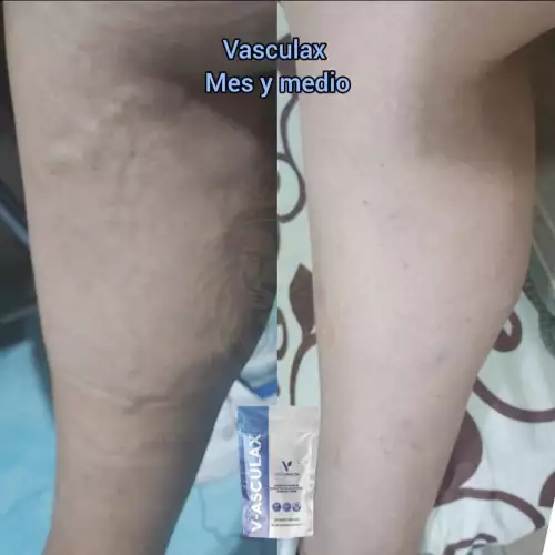 VASCULAX 60 Cápsulas - Vena Varices - La Plaza Morada